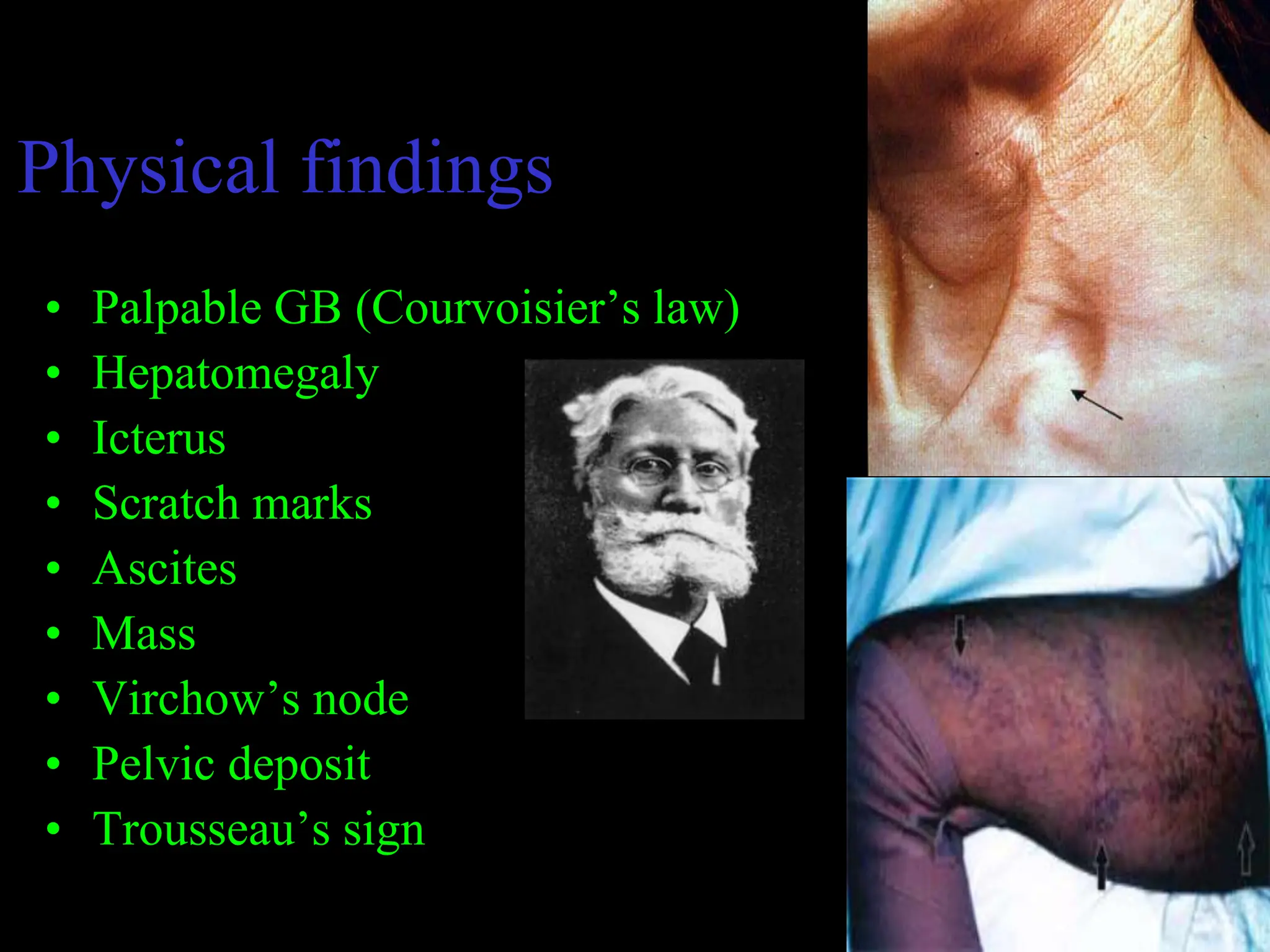 Periampullary CArcinoma .PPT.pptx download | PPTX