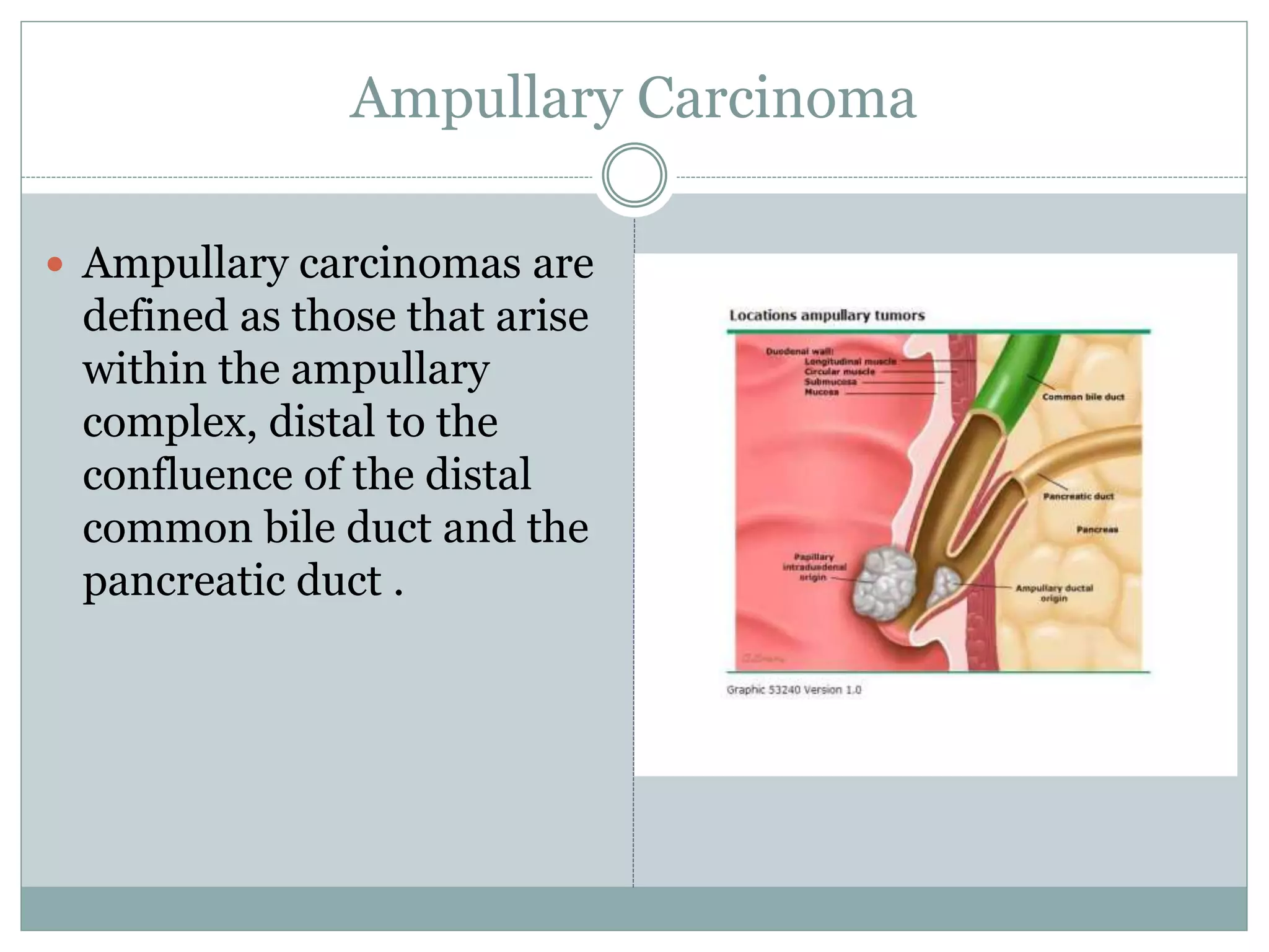 PERIAMPULLARY CARCINOMA.pptx
