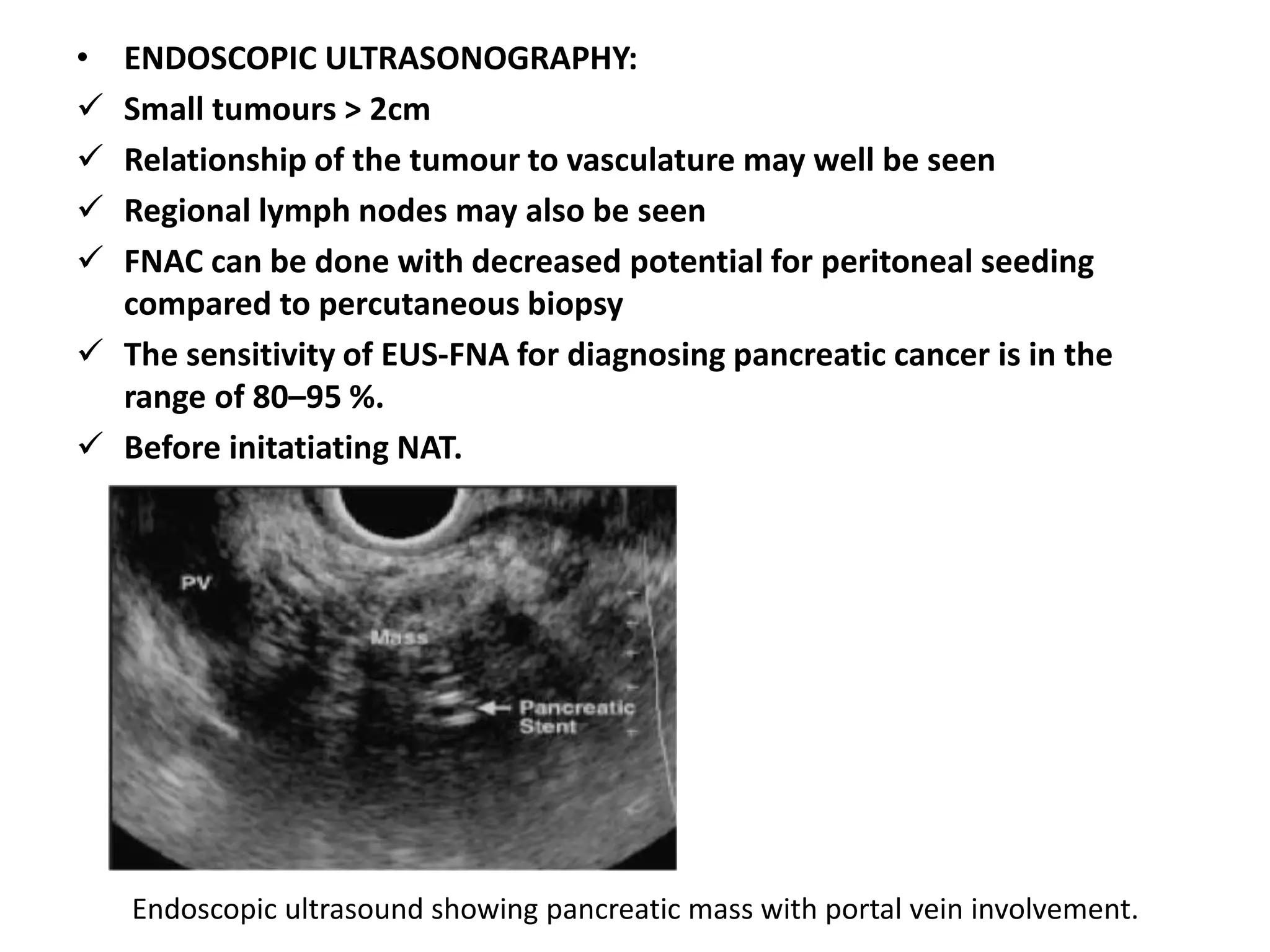 Periampullary_carcinoma_–diagnosis_with_staging,_preoperative (2).pptx