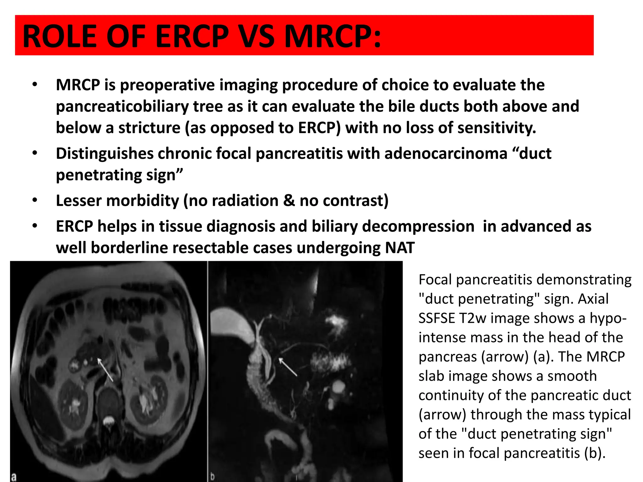 Periampullary_carcinoma_–diagnosis_with_staging,_preoperative (2).pptx