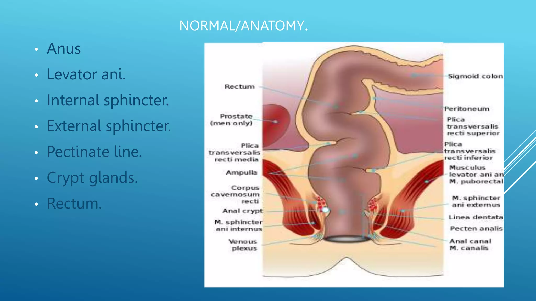 PERIANAL ABSCESS.pptx