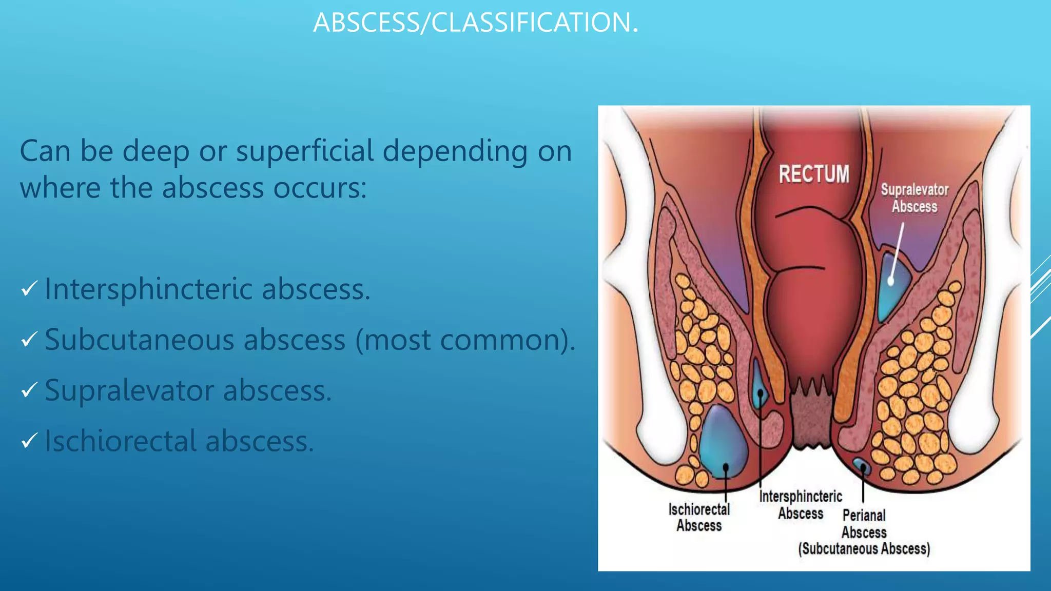 PERIANAL ABSCESS.pptx