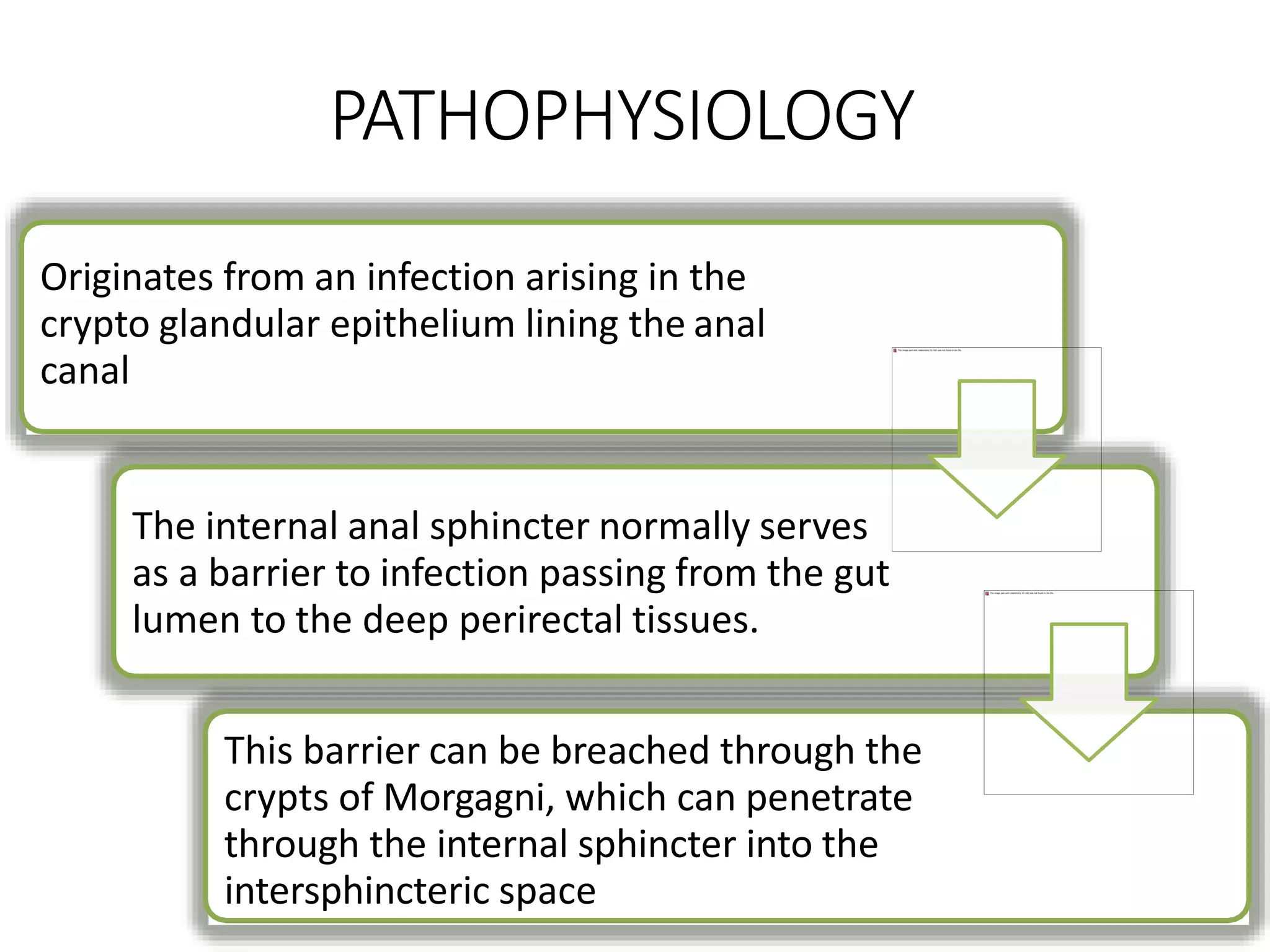 Perianal abscess | PPTX