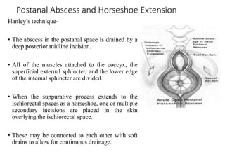 Horseshoe Abscess