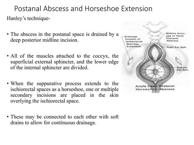 Perianal abscess | PPT