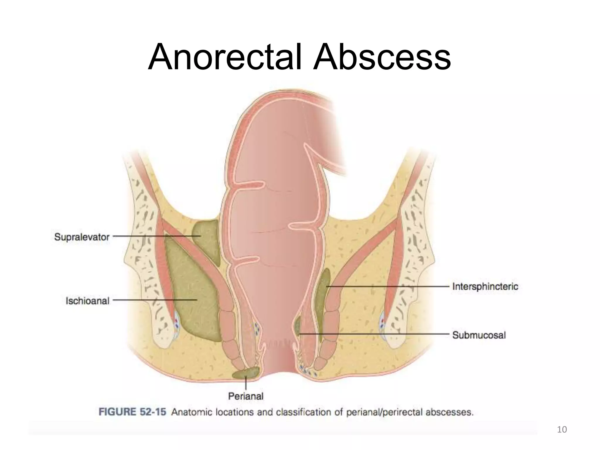 ANORECTAL ANATOMY & PERIANAL SEPSIS | PPTX