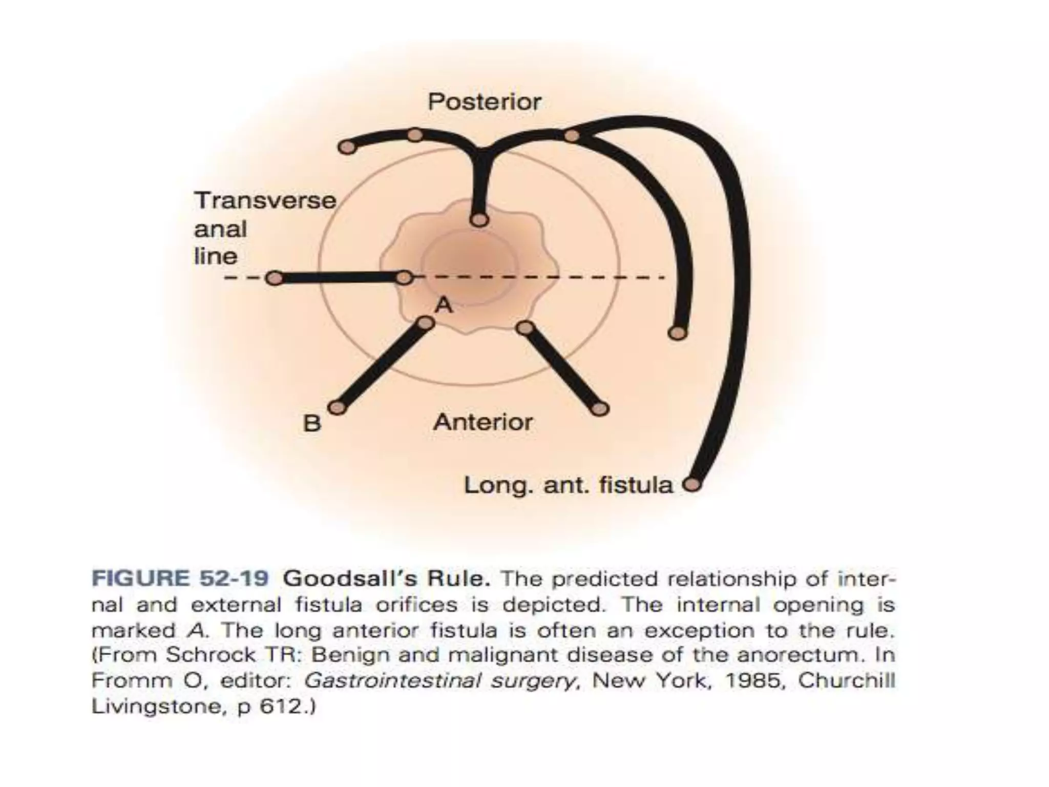ANORECTAL ANATOMY & PERIANAL SEPSIS | PPTX