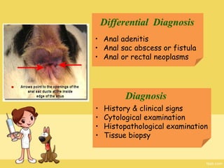 Perianal fistula | PPT