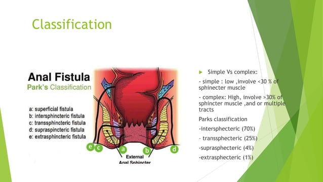 Perianal fistula disease.pptx | Digestive Disorders | Diseases and ...