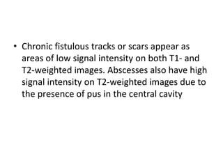 Peri anal fistula mri | PPTX