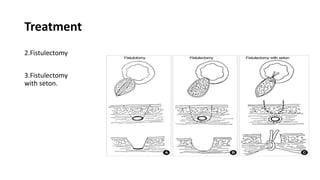 Perianal surgeris.pptx