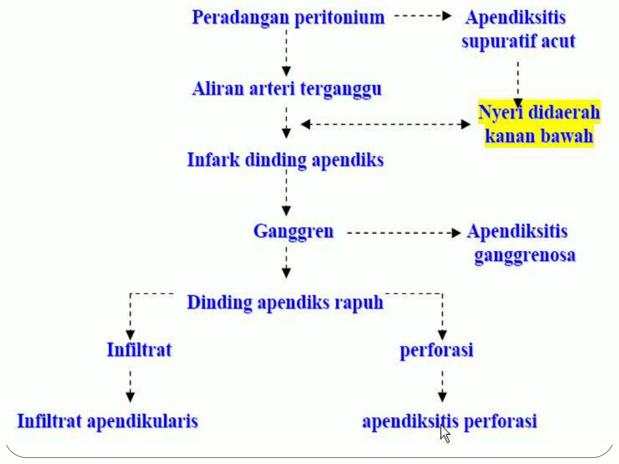 Peri apendikuler infiltrat | PPTX
