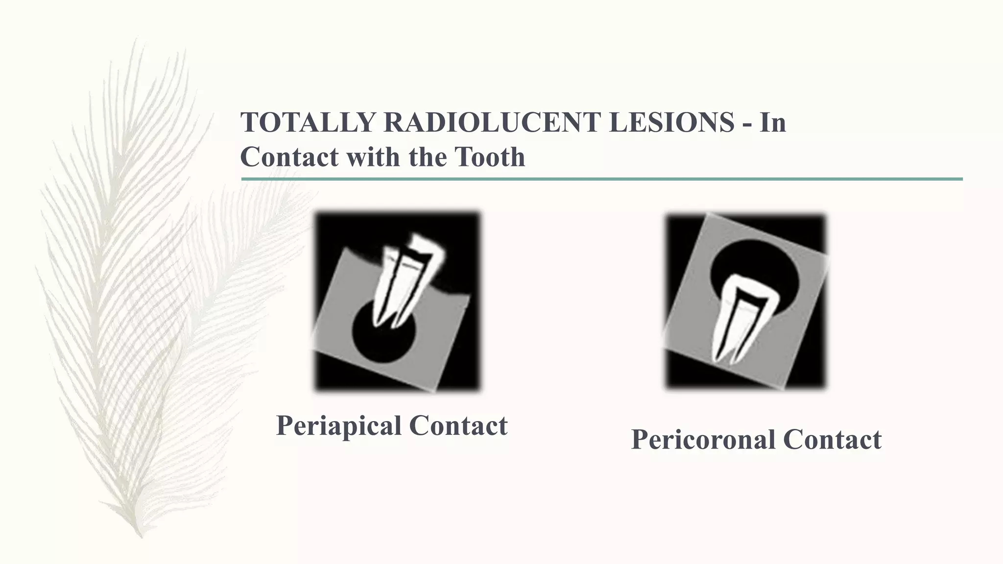 Differential diagnosis of periapical radiolucent lesion | PPTX