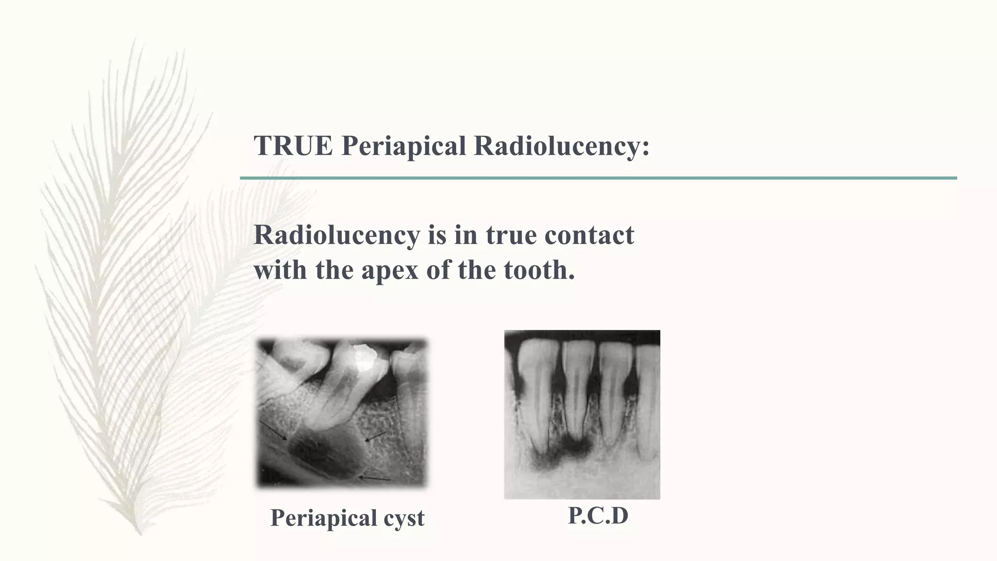 Differential diagnosis of periapical radiolucent lesion | PPTX