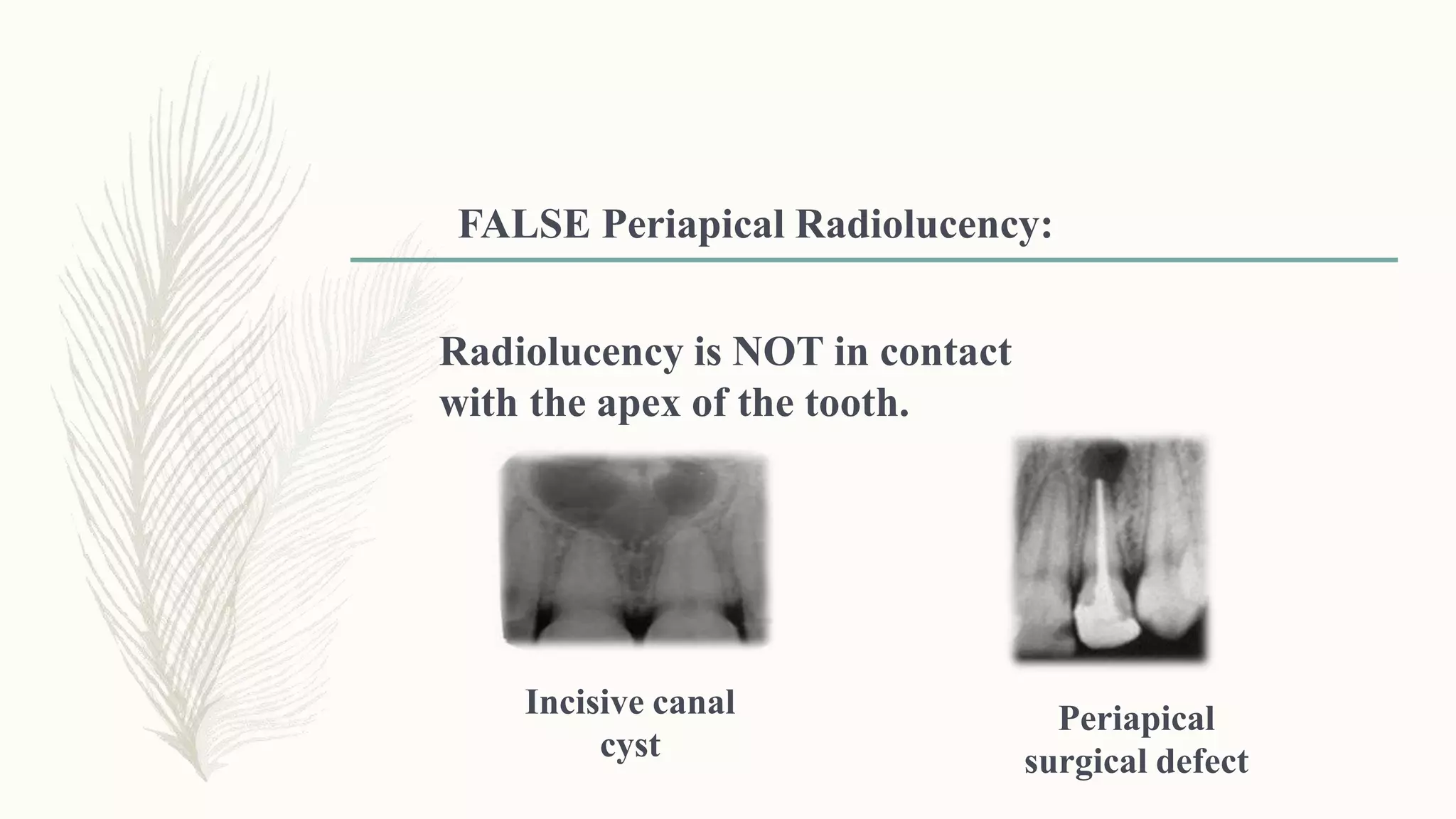 Differential diagnosis of periapical radiolucent lesion | PPTX