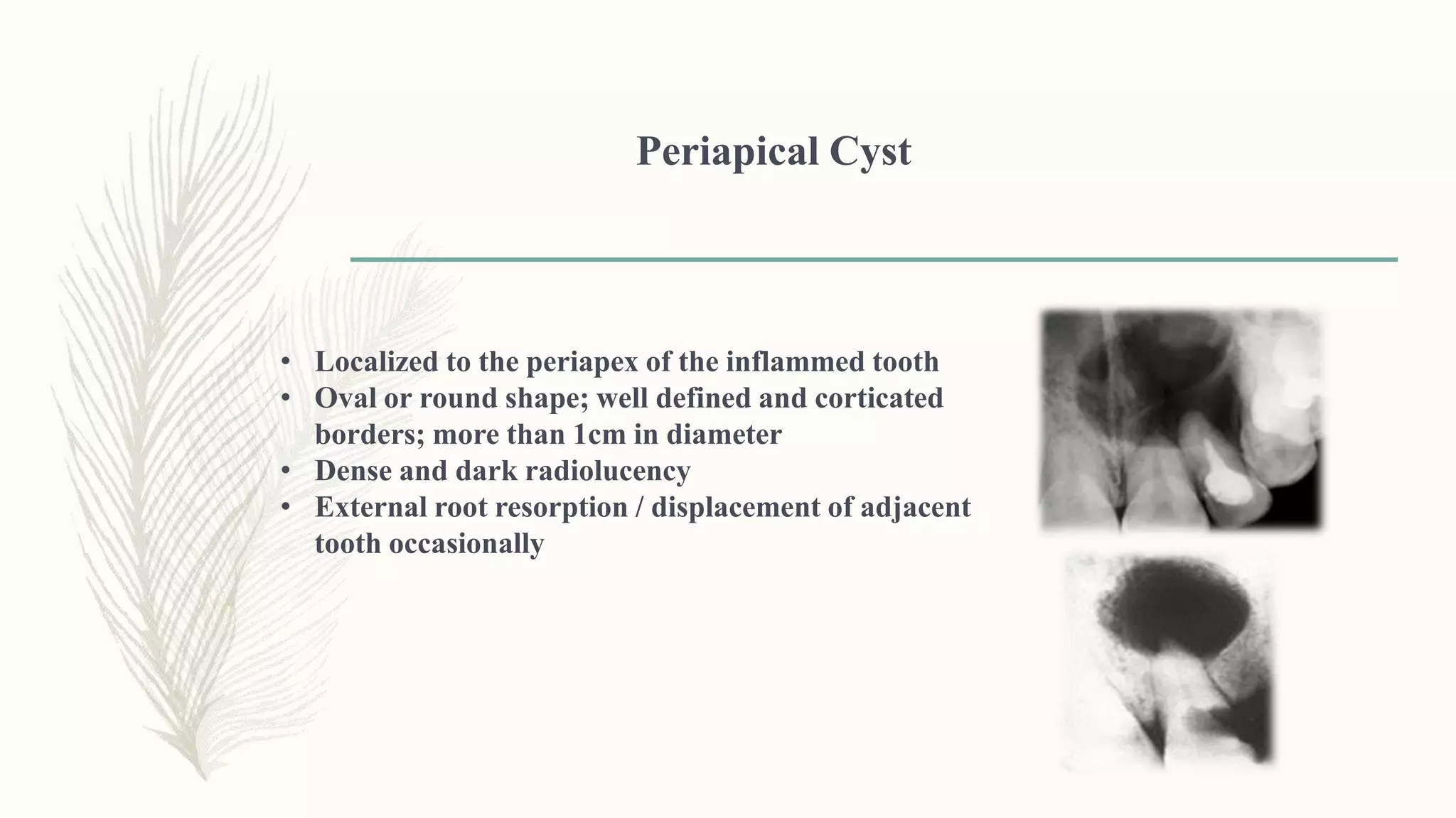 Differential diagnosis of periapical radiolucent lesion | PPTX