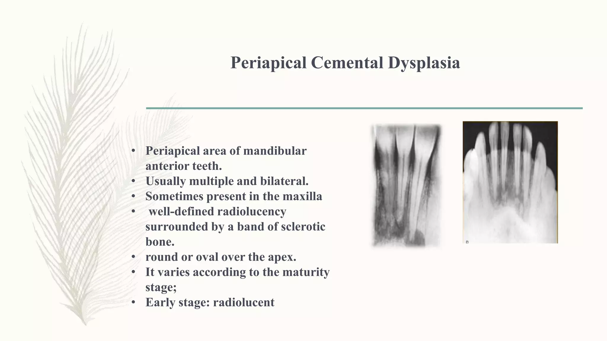 Differential diagnosis of periapical radiolucent lesion | PPTX