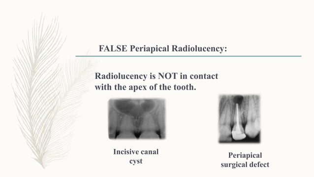 Differential diagnosis of periapical radiolucent lesion | PPTX | Dental ...