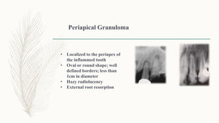 Differential diagnosis of periapical radiolucent lesion | PPTX