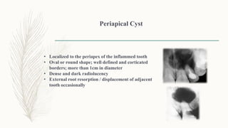 Differential diagnosis of periapical radiolucent lesion | PPTX
