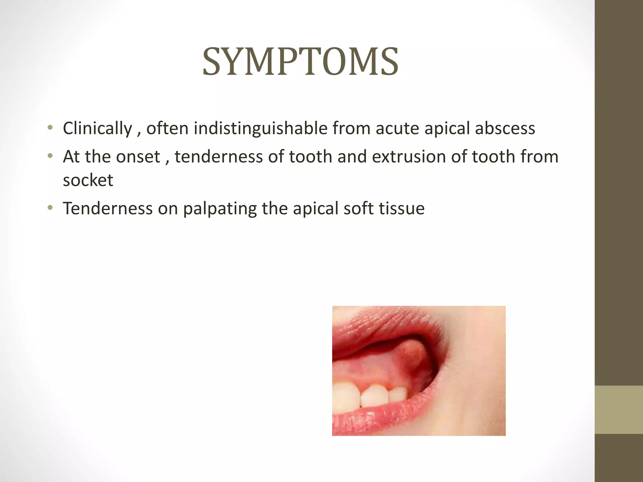 Periapical Abscess.pptx | Dental Health | Diseases and Conditions