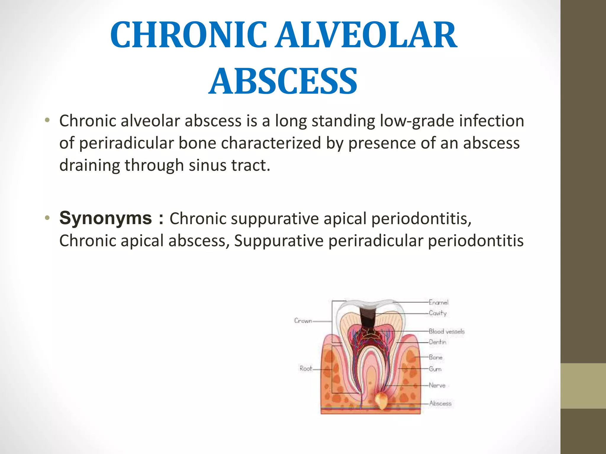 Periapical Abscess.pptx