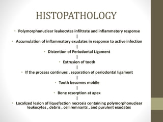 Periapical Abscess.pptx