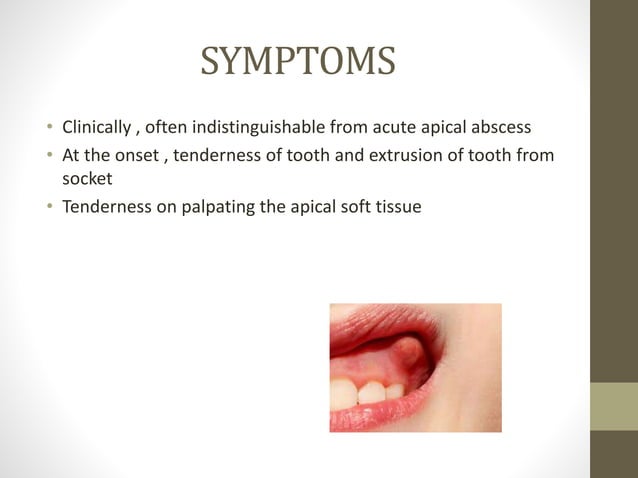 Periapical Abscess.pptx | Dental Health | Diseases and Conditions