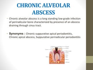 Periapical Abscess.pptx