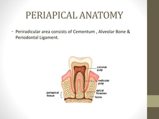 Periapical Abscess.pptx