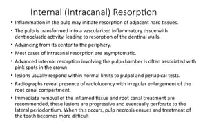 Periapical and pulpal pathosis.pptx by shumaila siddiqui | PPT