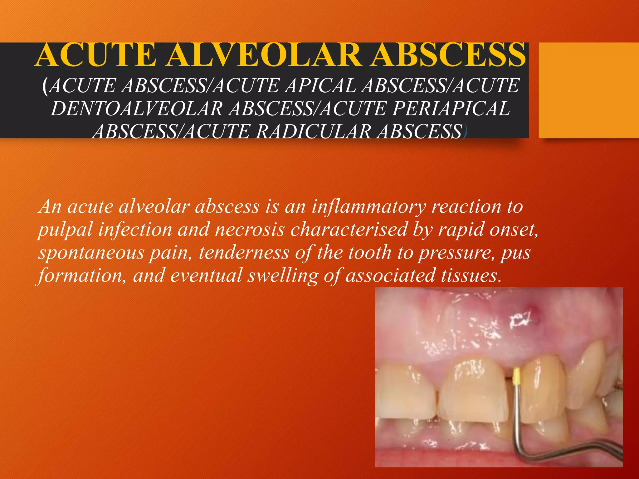 Periapical diseases and classification | PPTX