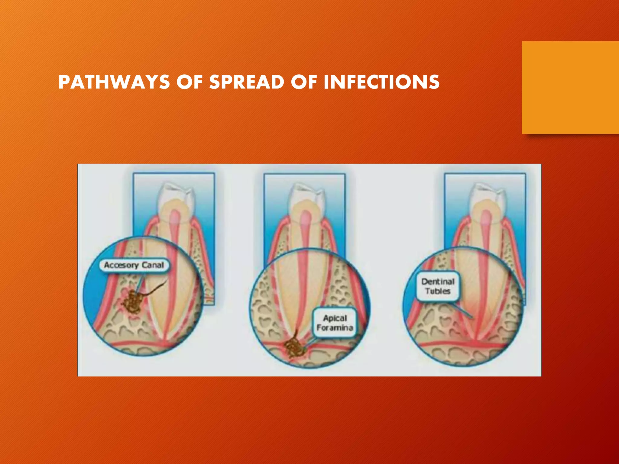 Periapical diseases and classification | PPTX