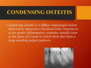 Periapical diseases and classification | PPTX