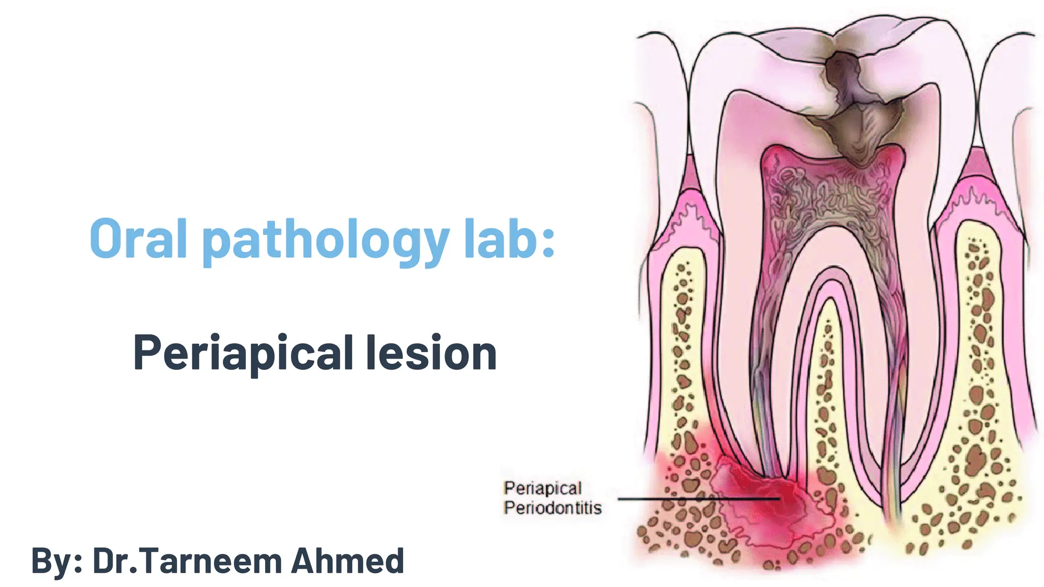 oral Pathology Lab periapical lesion .pdf