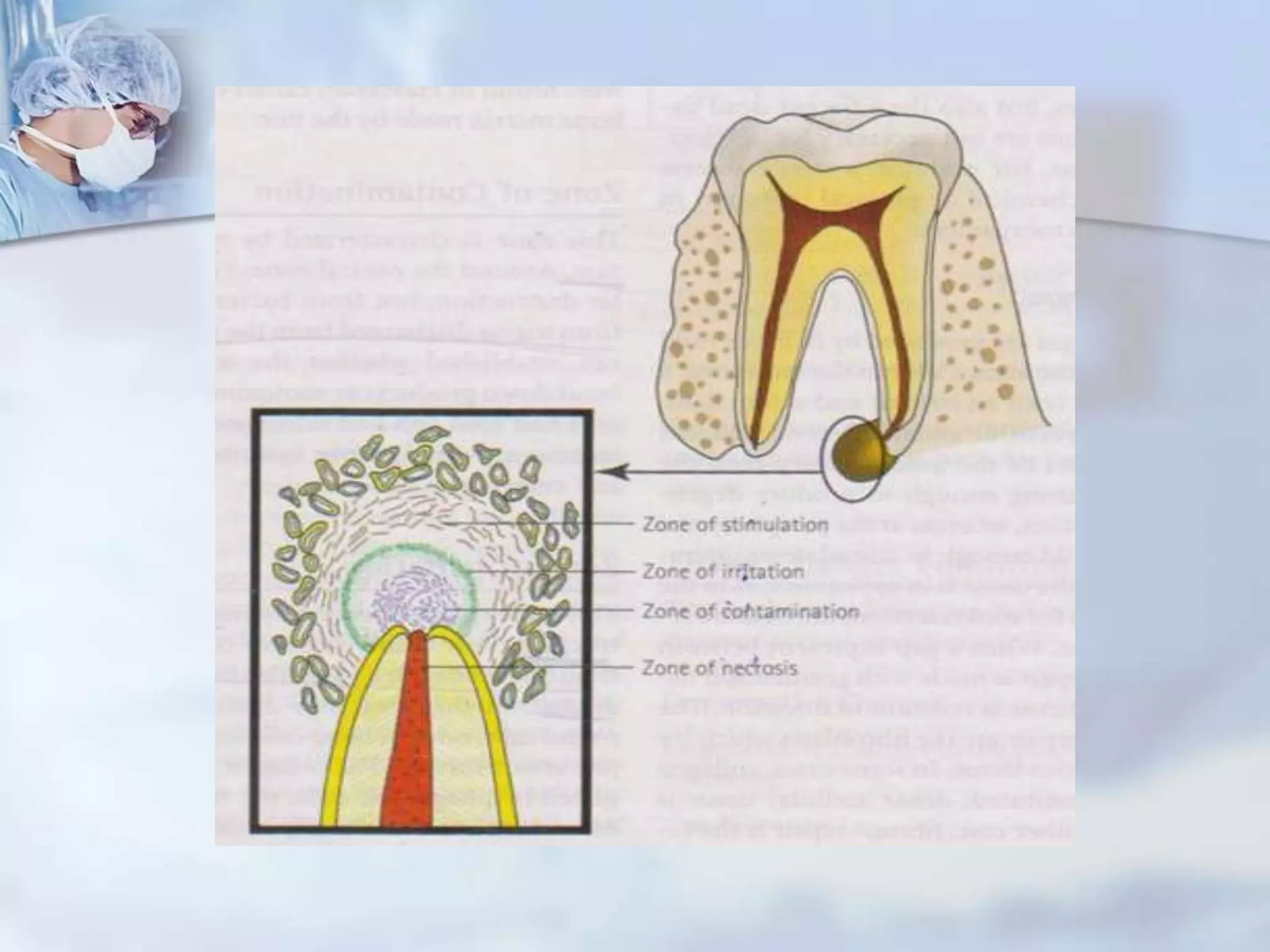 Periapical pathology | PPTX