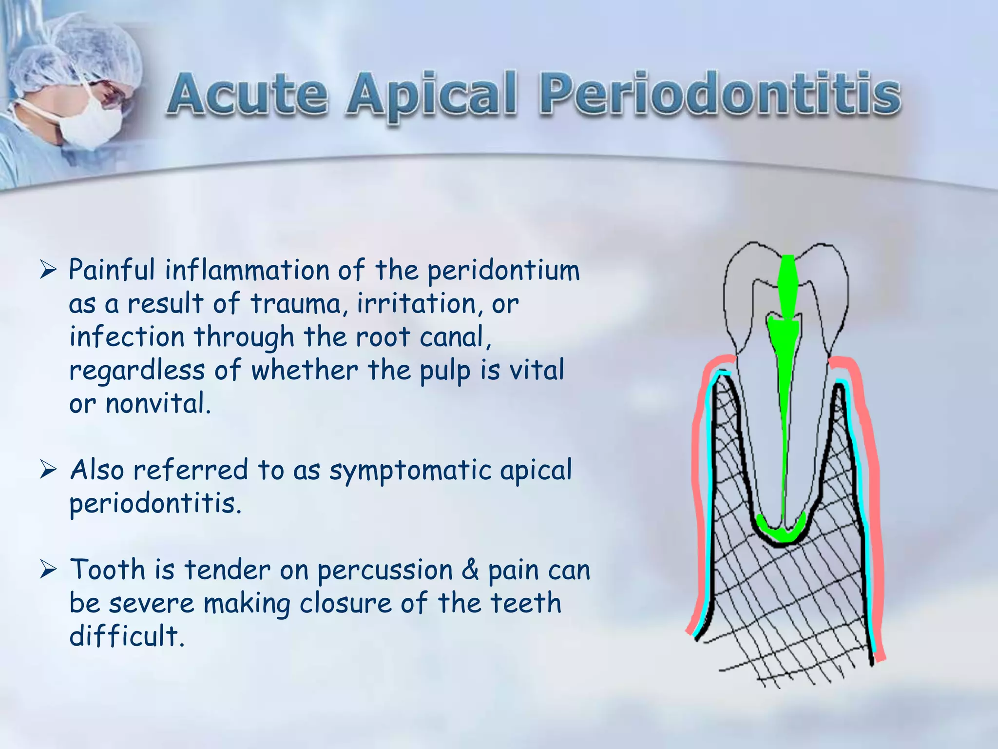 Periapical pathology | PPTX
