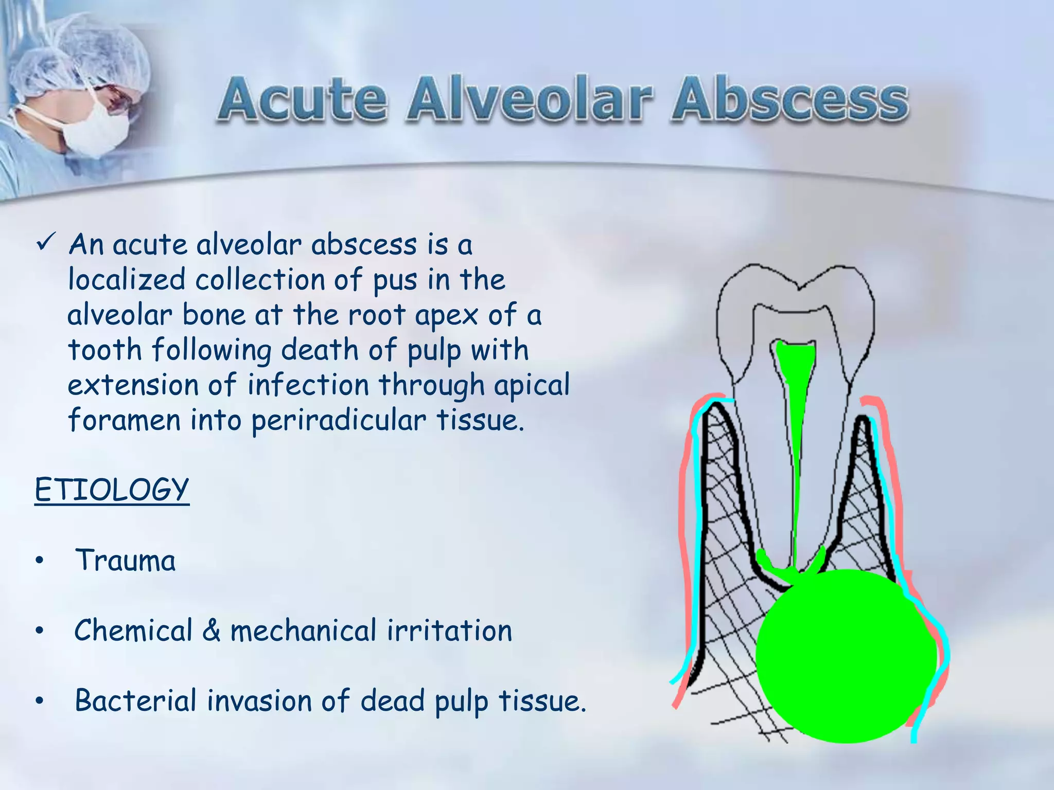 Periapical pathology | PPTX
