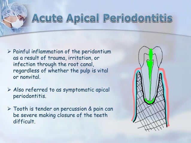 Periapical pathology | PPTX