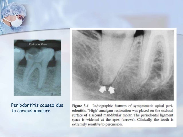 Apical Foramen Histology