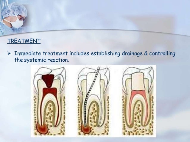 Apical Foramen Histology