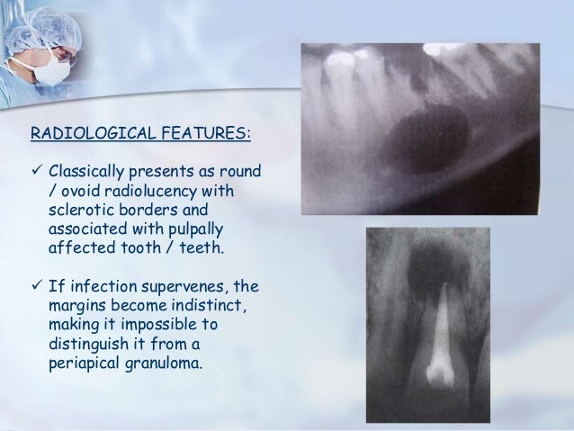 Periapical pathology