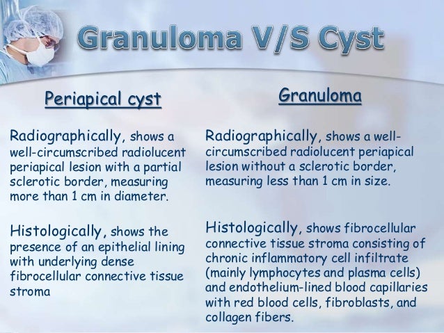 Periapical Granuloma Vs Cyst