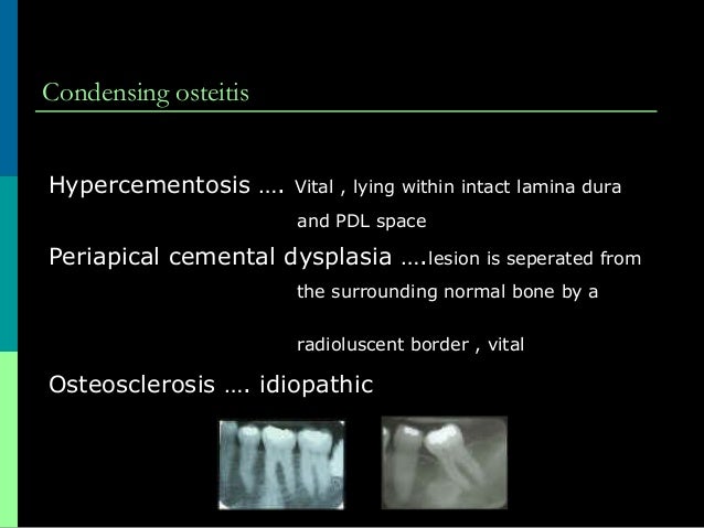 Periapical pathology 22 (1)