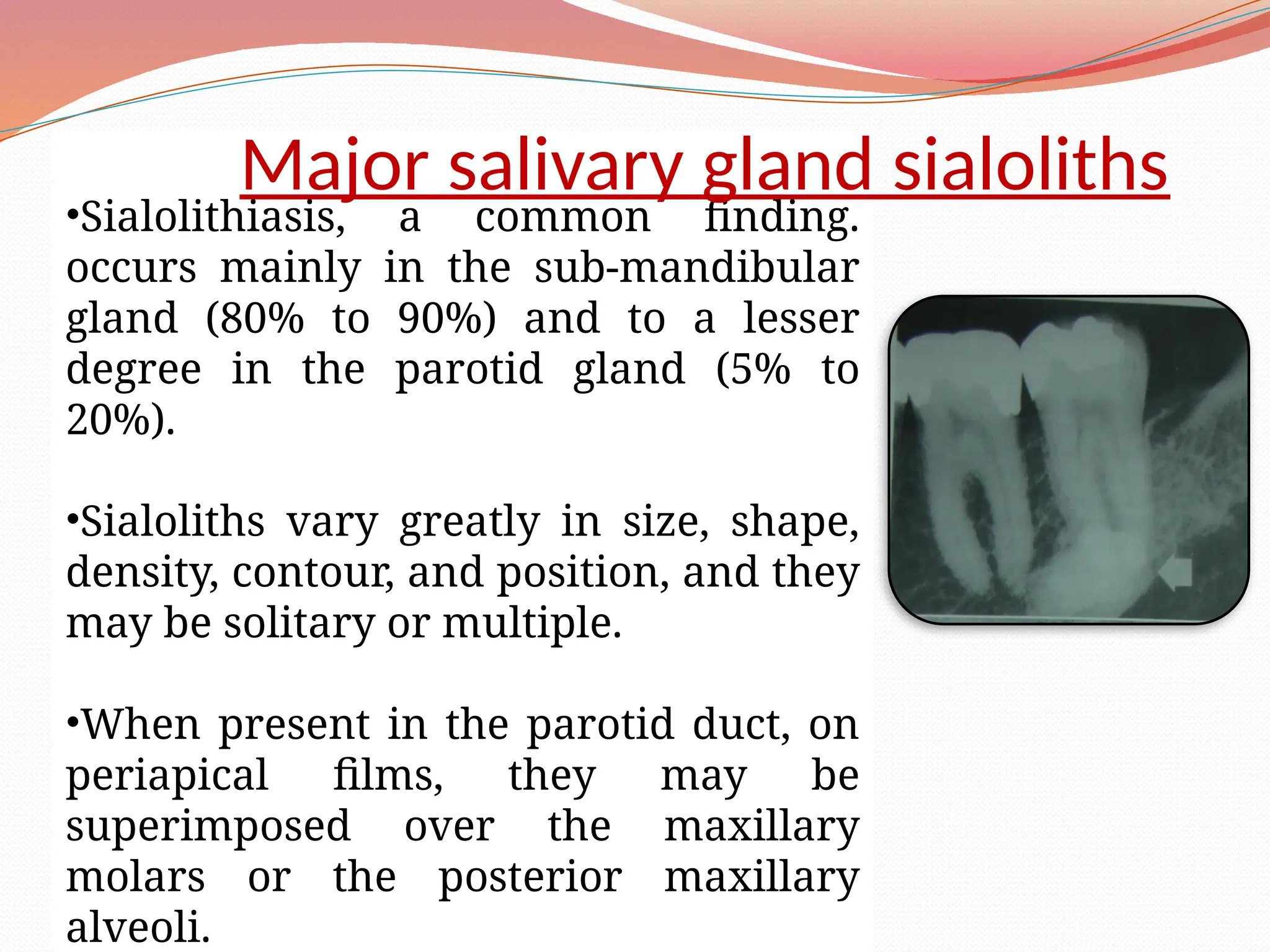 periapical & pericoronal radiopacity.pptx