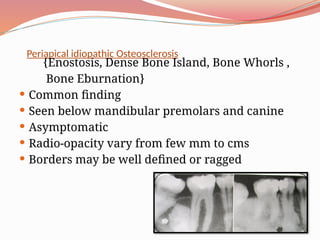 periapical & pericoronal radiopacity.pptx