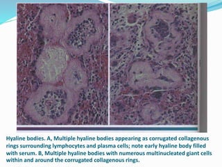 Periapical power point | PPT