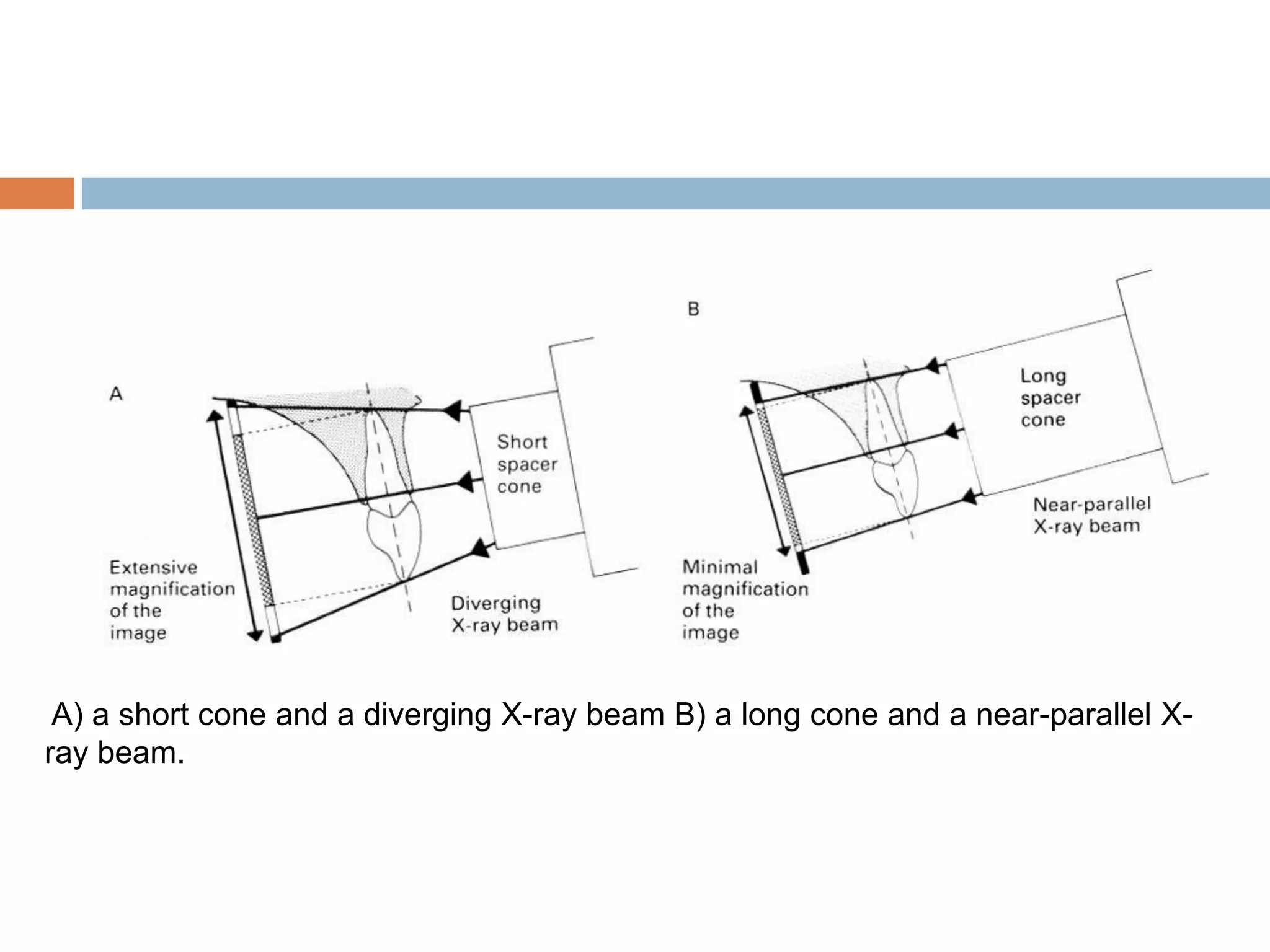 Periapical radiograph | PPTX