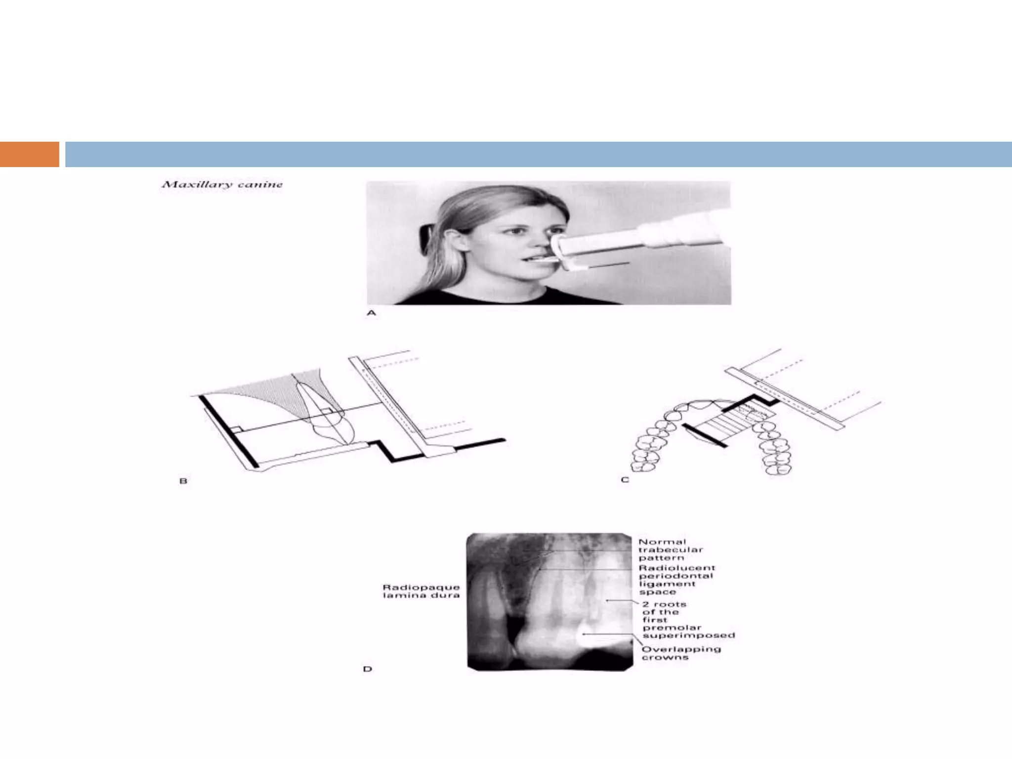 Periapical radiograph | PPTX