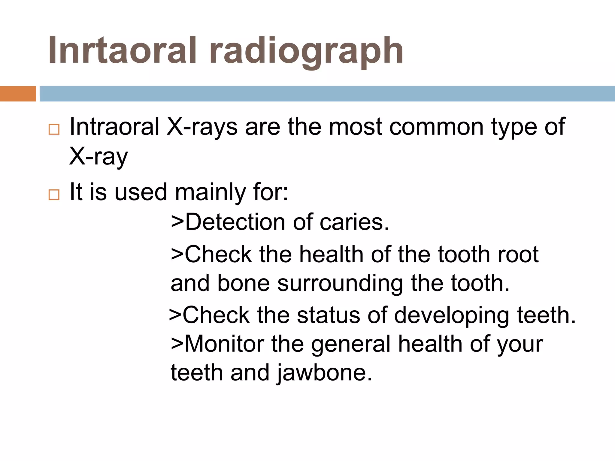 Periapical radiograph | PPTX